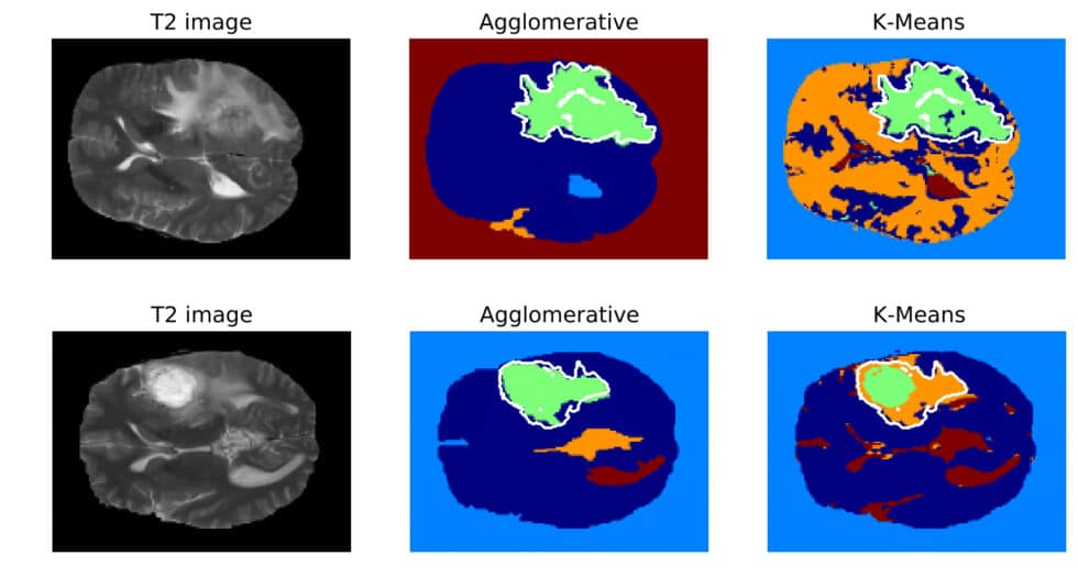 MRI Analysis - case study - Cancer Center - Your Digital Center and LIS ...