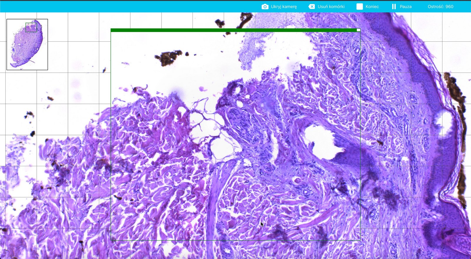 Featured article on Allied Vision - Cancer Center - Your Digital Center ...