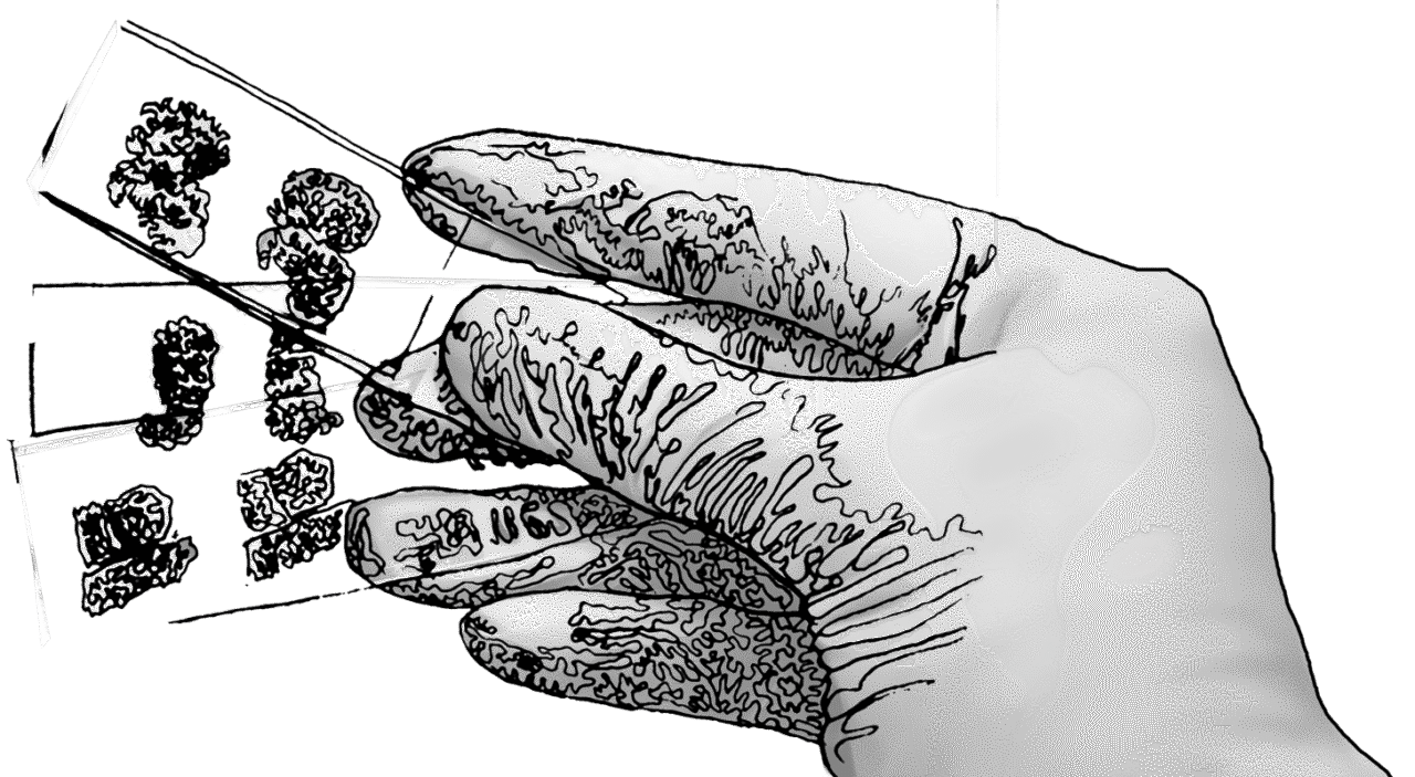 LIS for Pathology - Cancer Center - Your Digital Center and LIS for ...